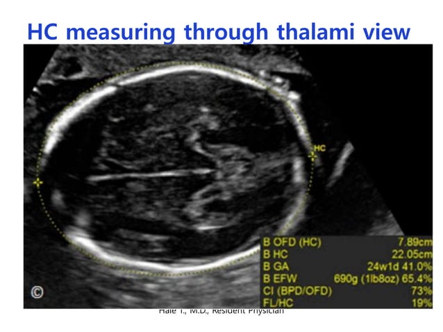 8. normal second trimester ultrasound | PDF | Pregnancy | Reproductive ...