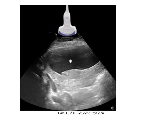 8. normal second trimester ultrasound | PDF | Pregnancy | Reproductive ...
