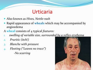 8. Drug eruption & urticaria | PPTX