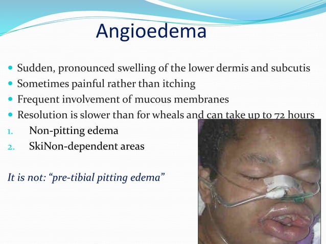 8. Drug eruption & urticaria | PPT