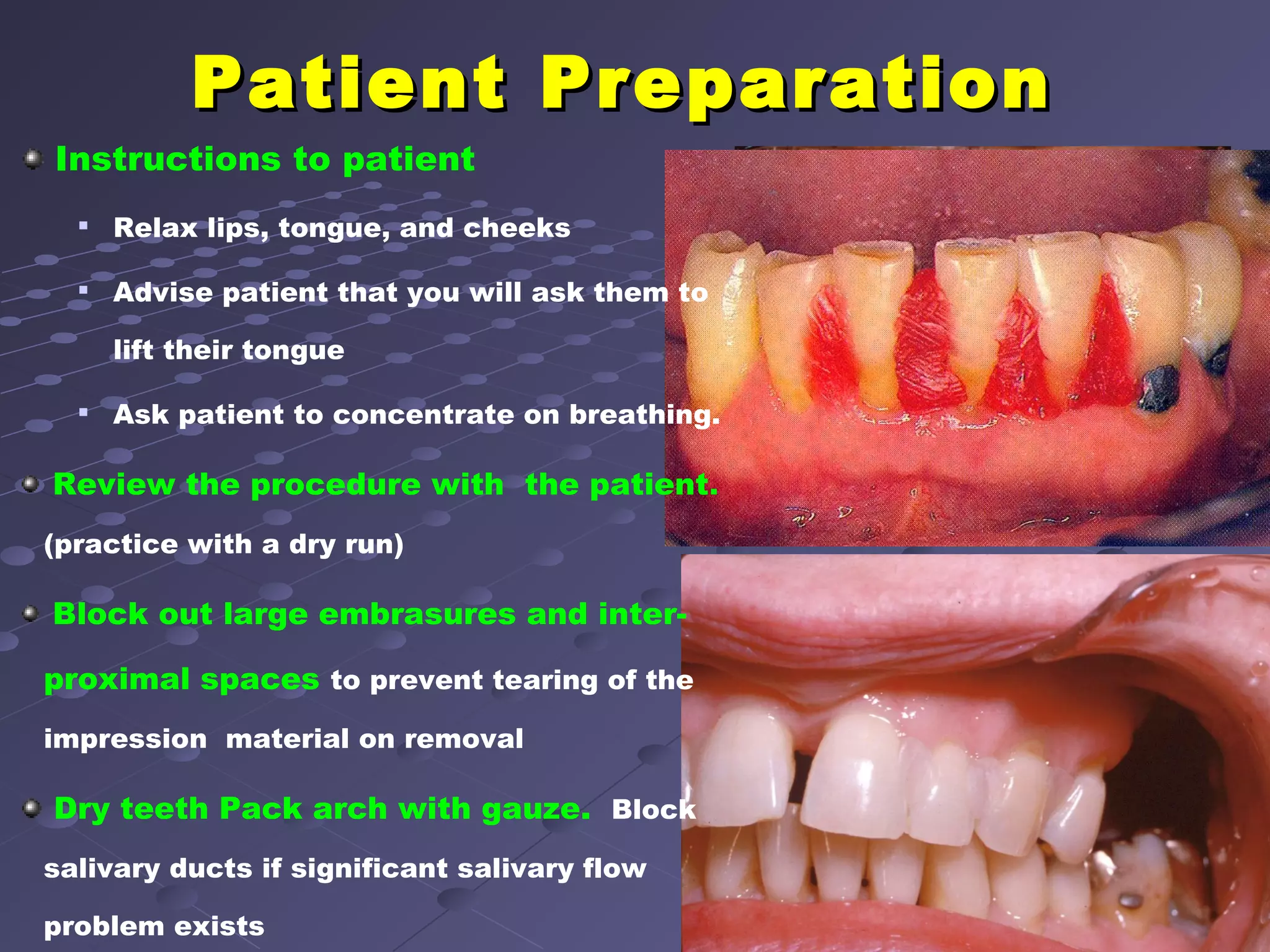 6. final impression techniques for removable partial dentures | PPT