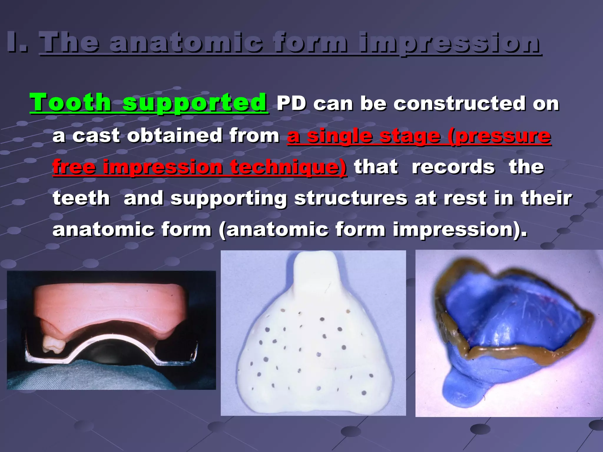 6. final impression techniques for removable partial dentures | PPT
