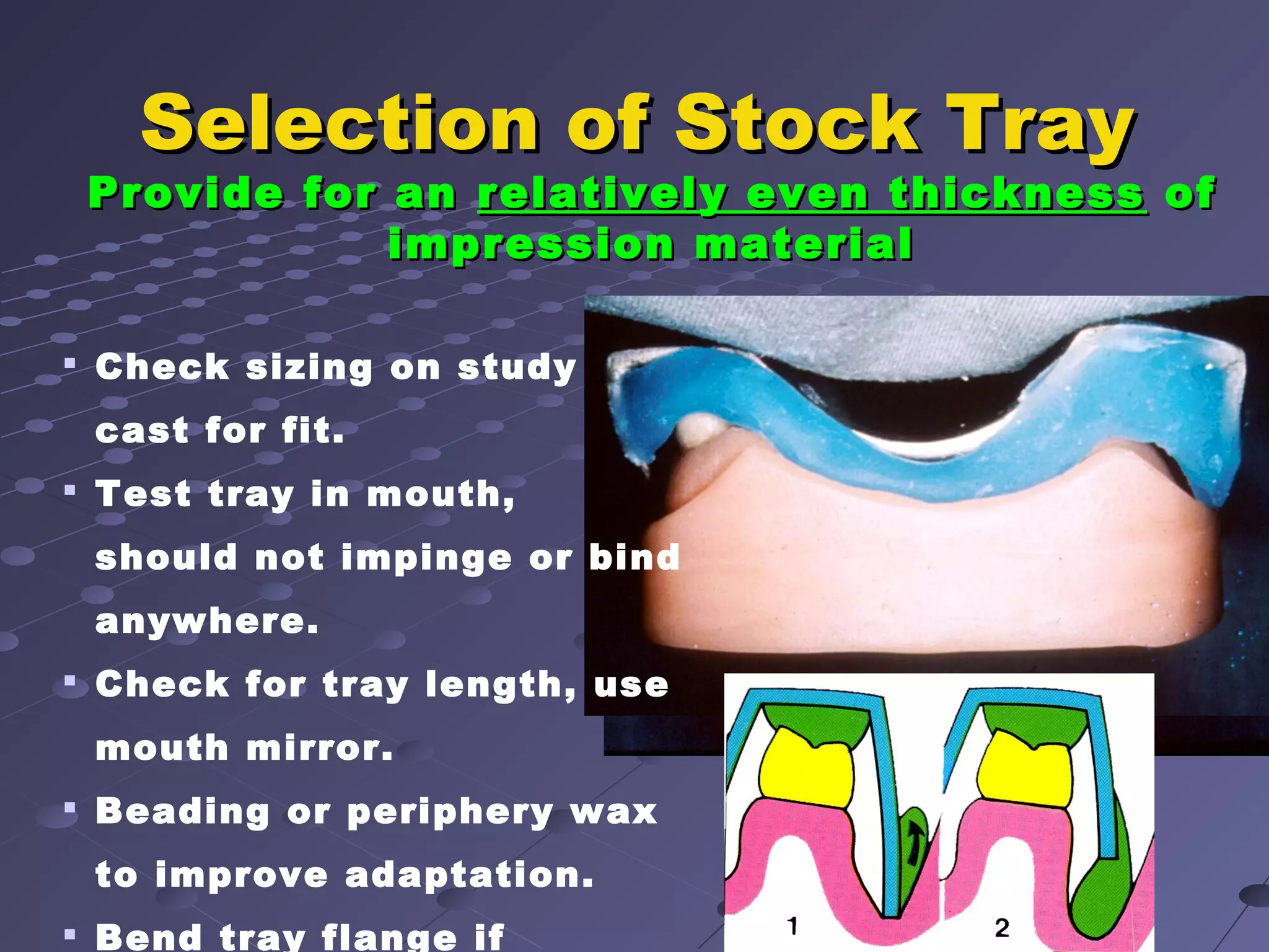 6. final impression techniques for removable partial dentures | PPT