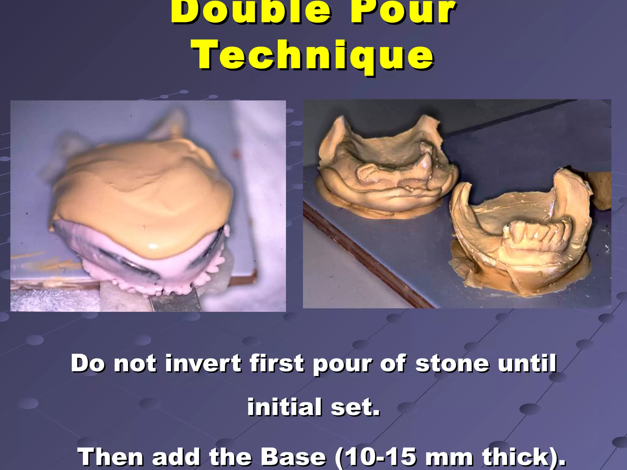 6. final impression techniques for removable partial dentures | PPT