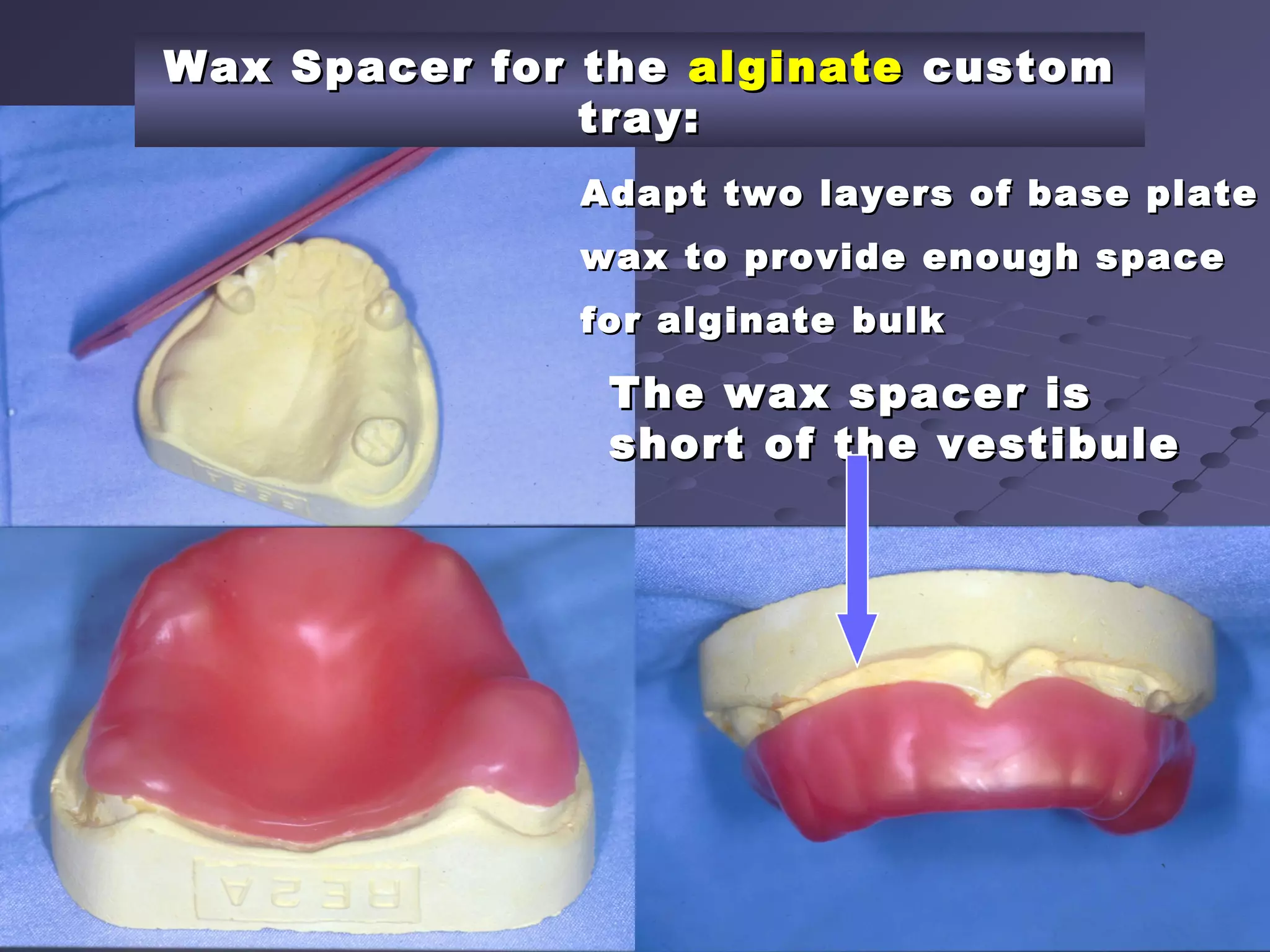 6. final impression techniques for removable partial dentures | PPT