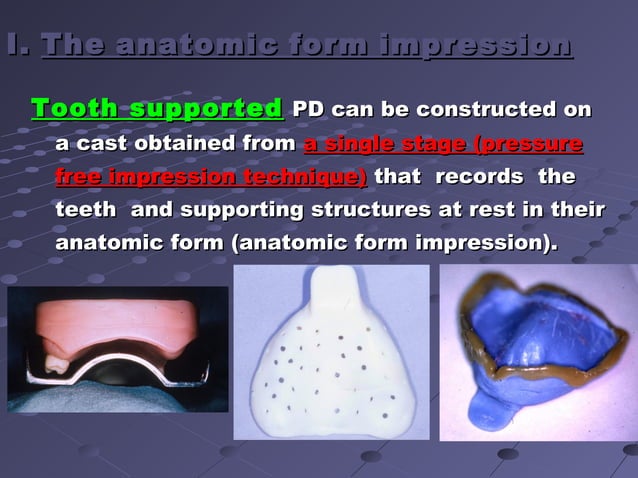 6. final impression techniques for removable partial dentures | PPT