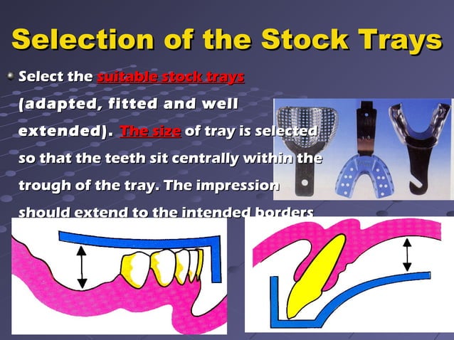 6. final impression techniques for removable partial dentures | PPT
