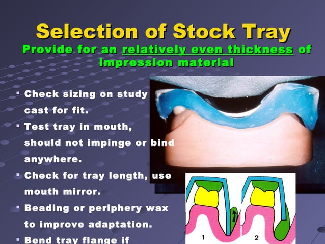 6. final impression techniques for removable partial dentures | PPT