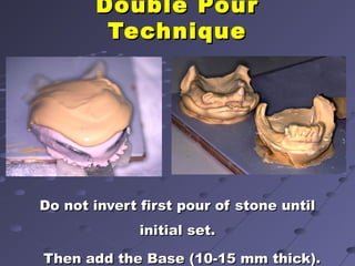 6. final impression techniques for removable partial dentures | PPT