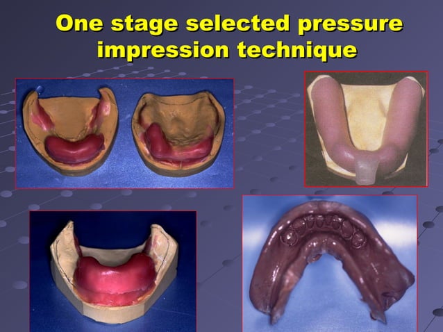 6. final impression techniques for removable partial dentures