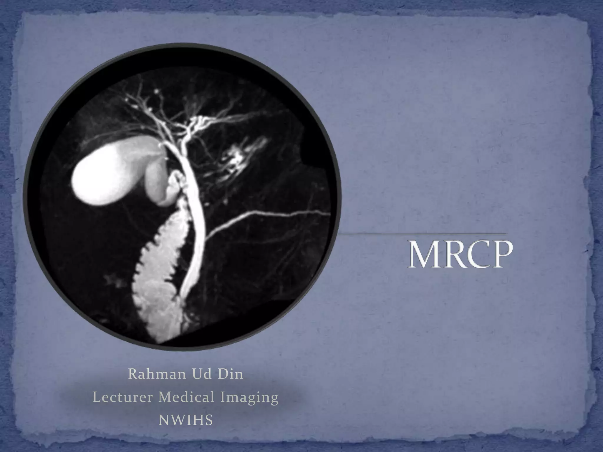Magnetic Resonance Cholangiopancreatography (MRCP) | PPTX