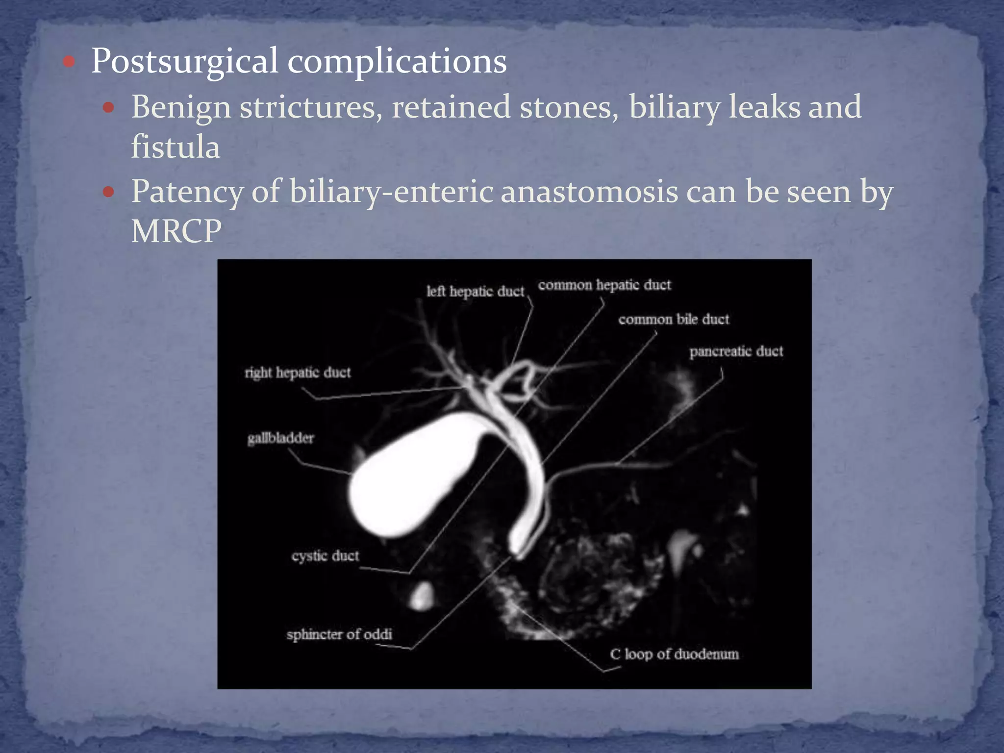 Magnetic Resonance Cholangiopancreatography (MRCP) | PPTX
