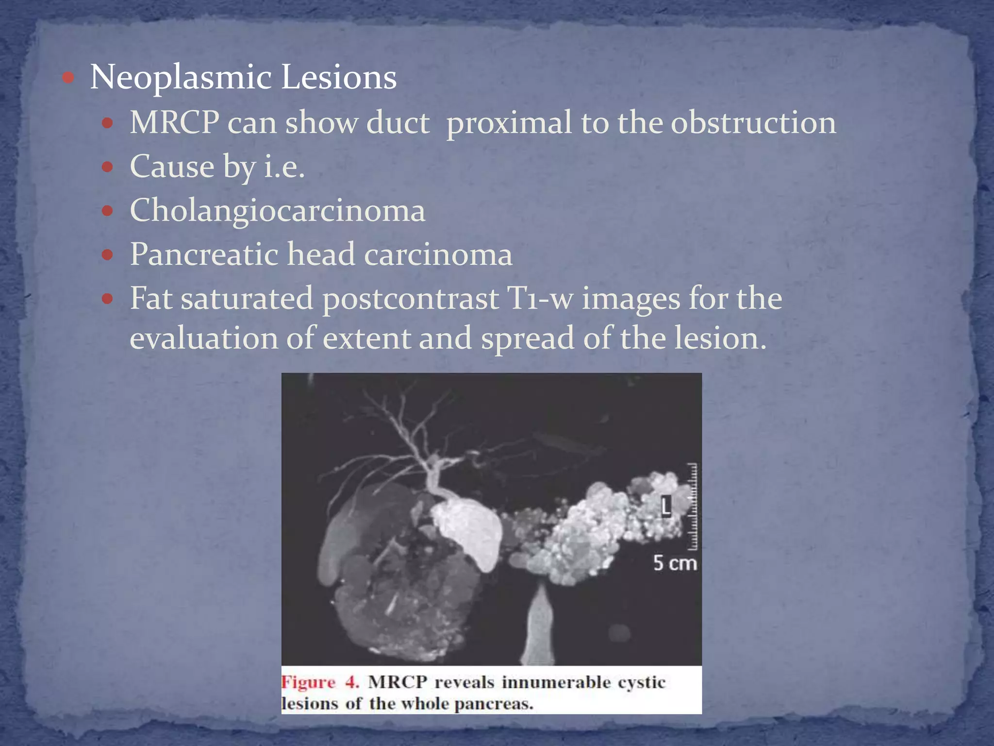 Magnetic Resonance Cholangiopancreatography (MRCP) | PPTX
