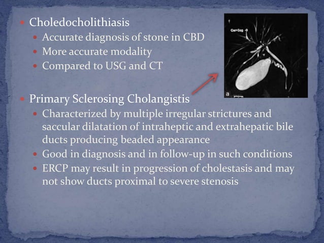 Magnetic Resonance Cholangiopancreatography Mrcp Pptx