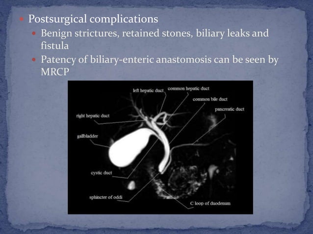 Magnetic Resonance Cholangiopancreatography (MRCP) | PPTX