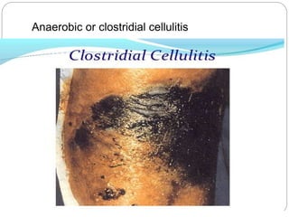 8. clostridium perfri | PPT