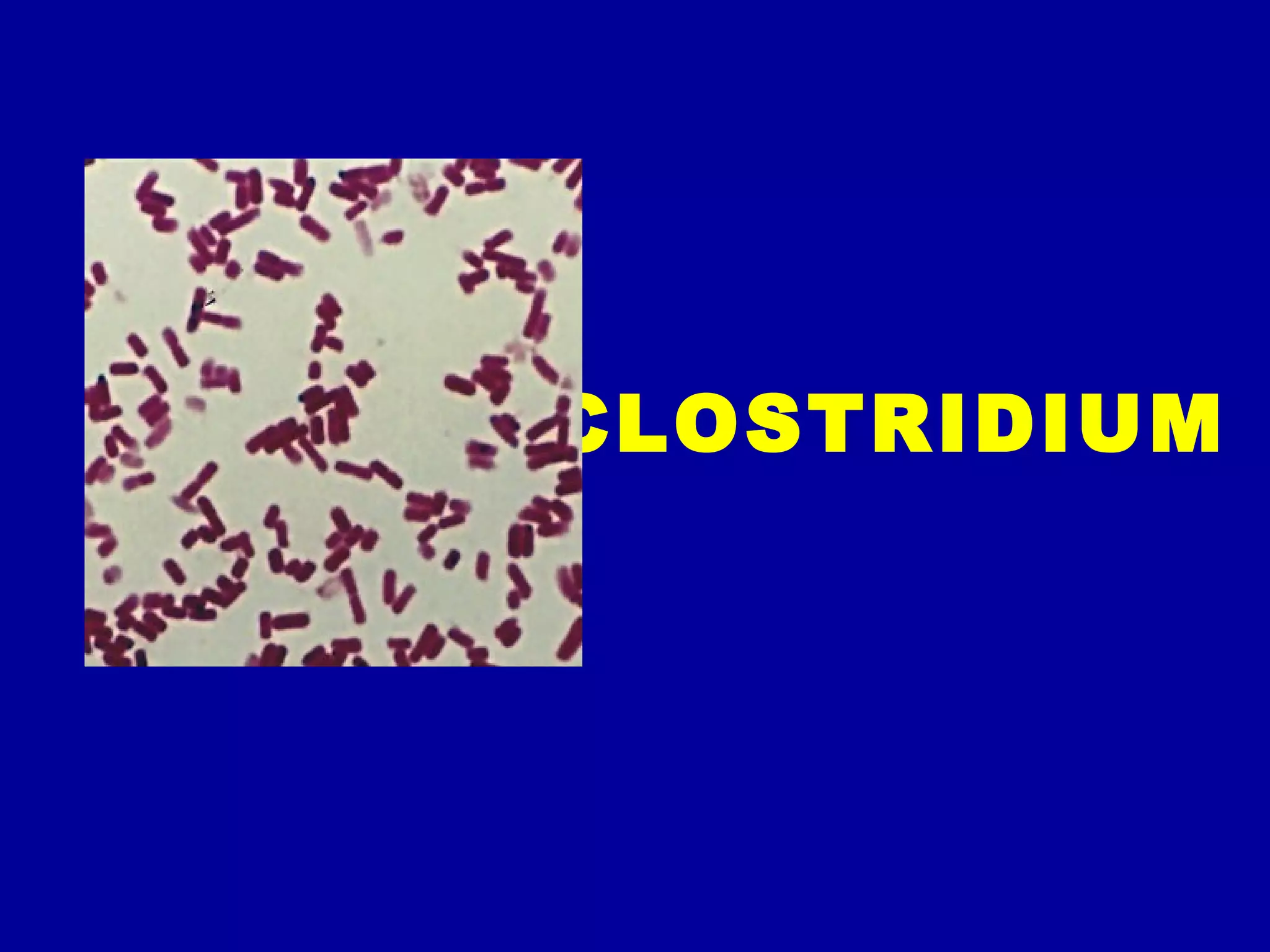 CLOSTRITIUM (clostridia as human pathogens) | PPT