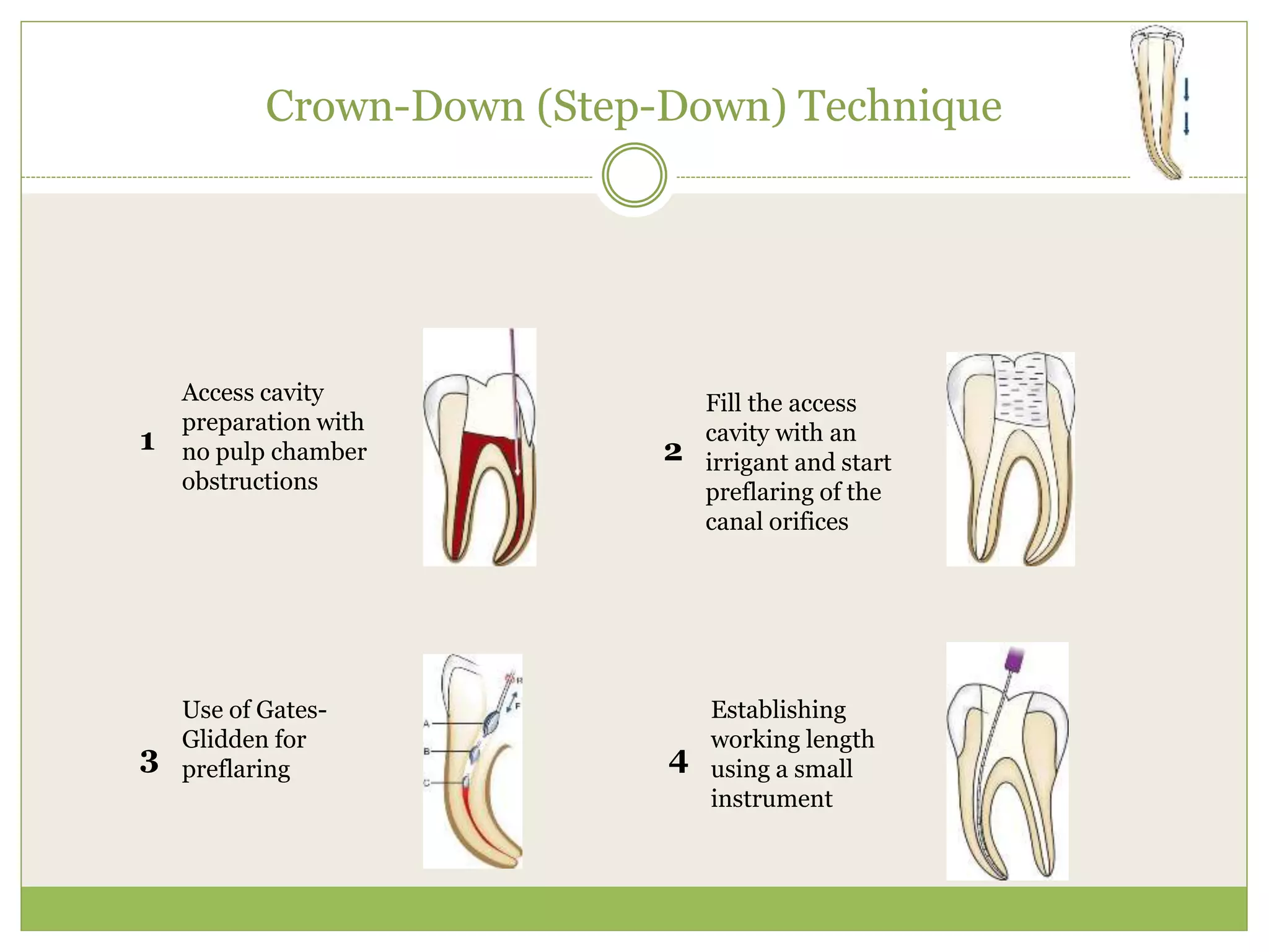 CLEANING AND SHAPING IN ENDODONTICS | PPTX