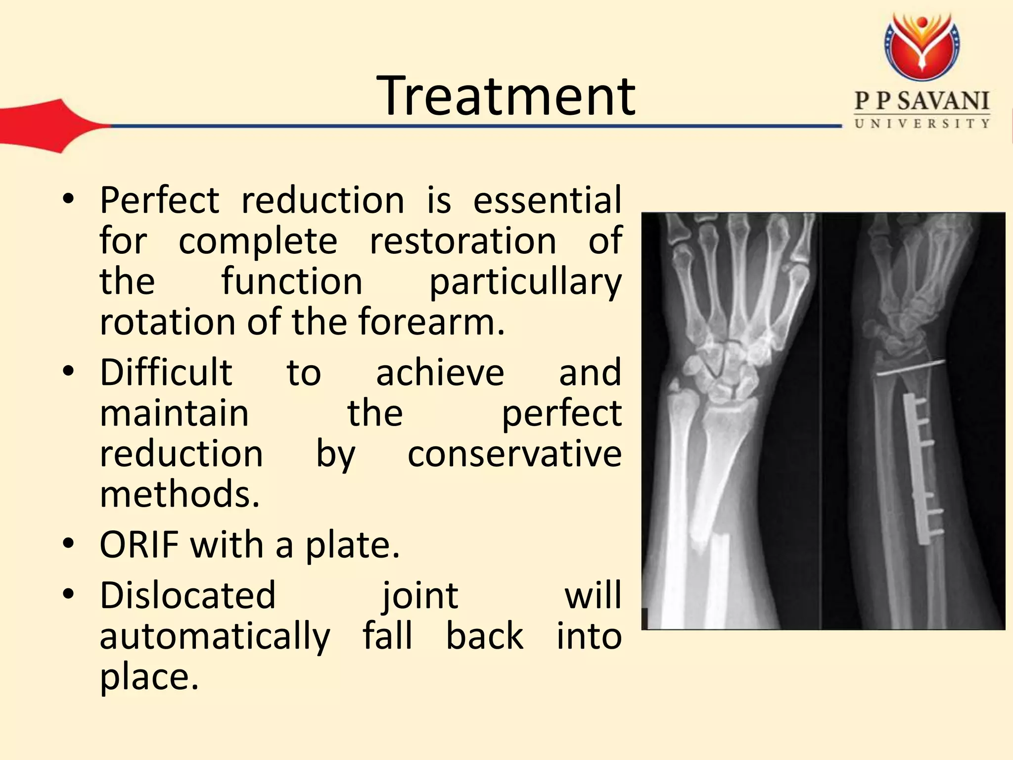 8. Forearm bone fractures | PPTX