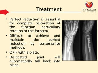 8. Forearm bone fractures | PPTX