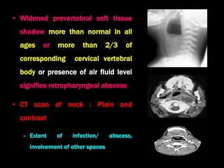 8. deep neck space infections | PPT