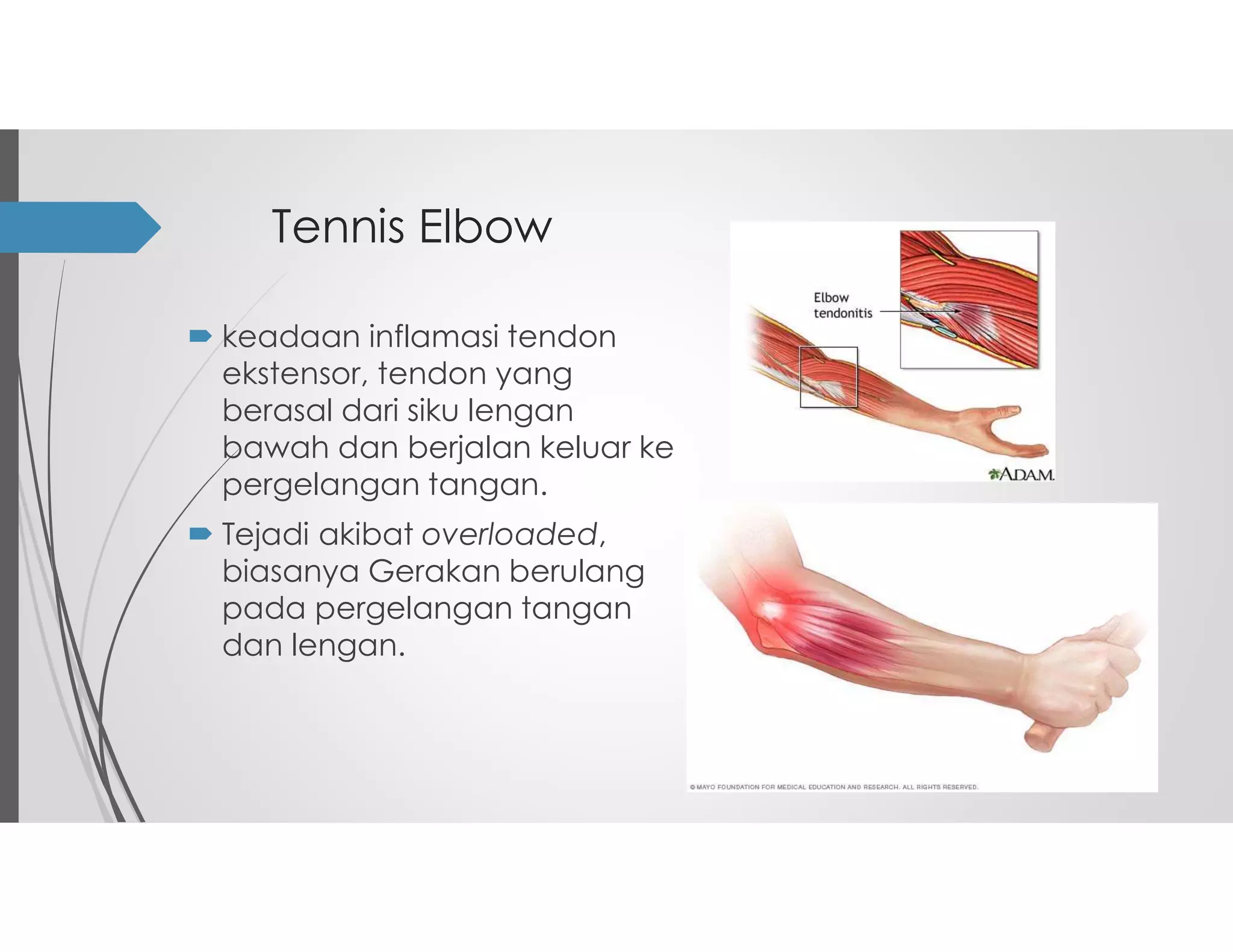 8.3. BIOMEKANIKA --- MUSCULOSKELETAL DISORDERS / GANGGUAN OTOT RANGKA | PDF