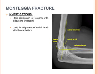 Monteggia fracture & galeazzi fracture | PPTX