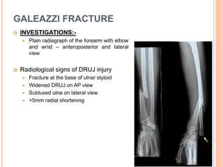 Monteggia fracture & galeazzi fracture | PPTX