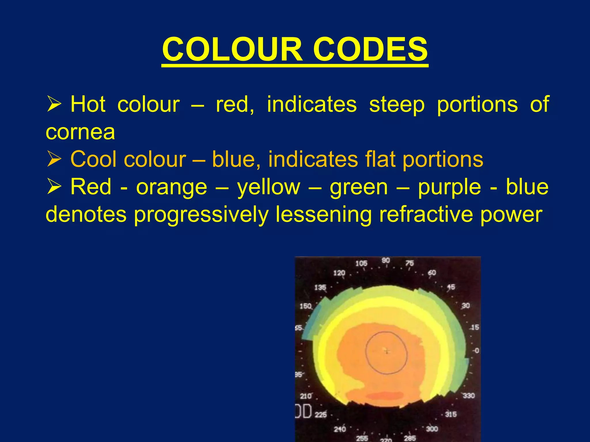 Corneal topography | PPT