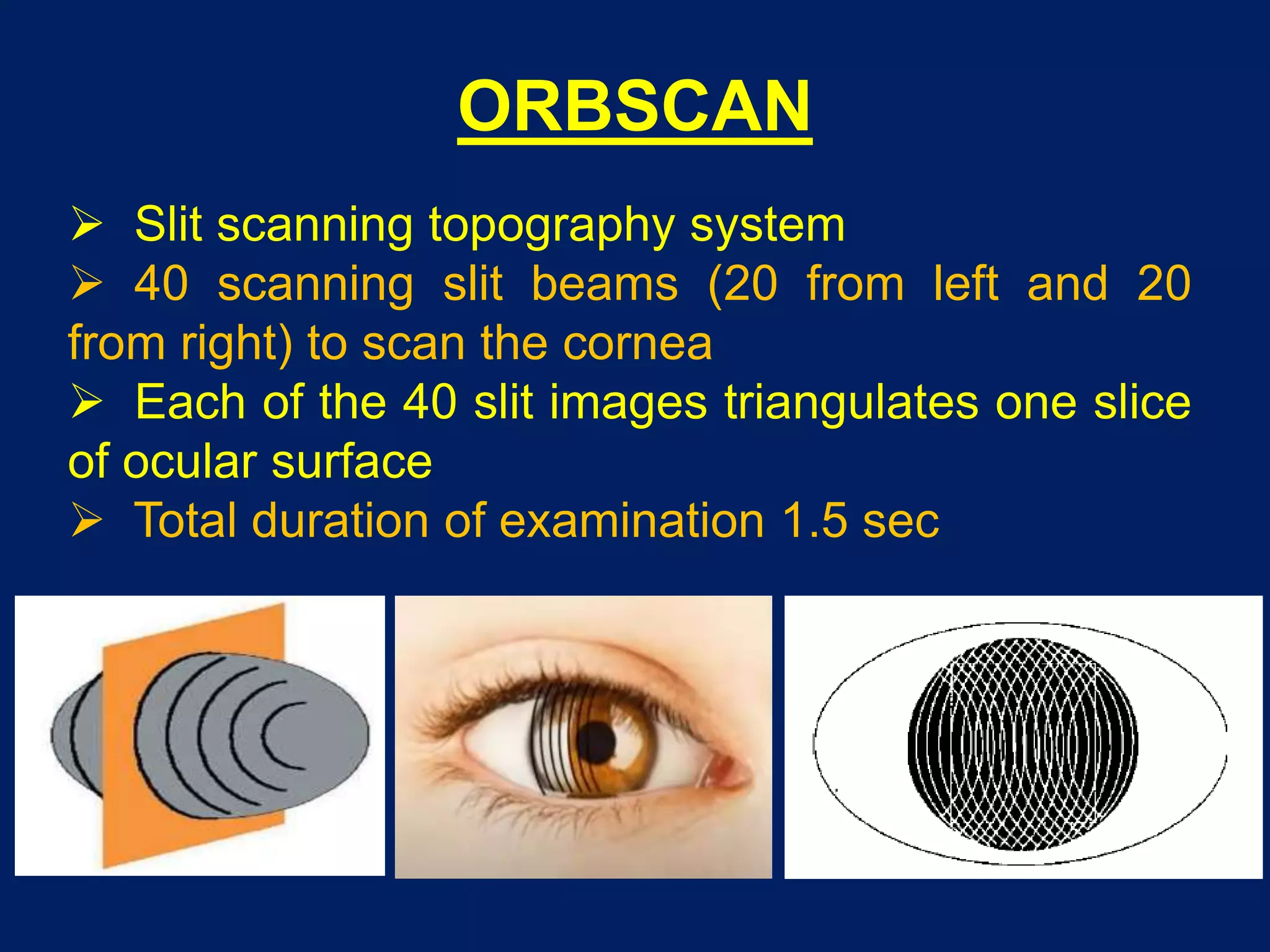 Corneal topography | PPT