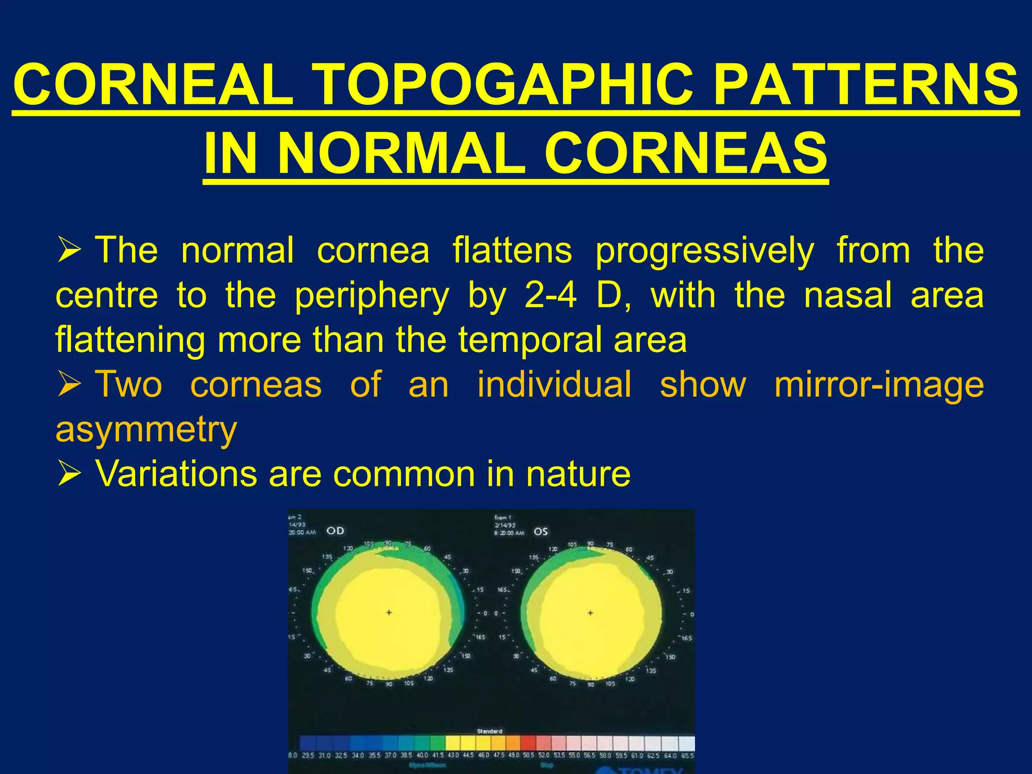 Corneal topography | PPT