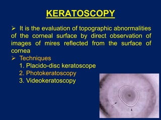 Corneal topography | PPT