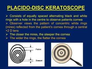 Corneal topography | PPT