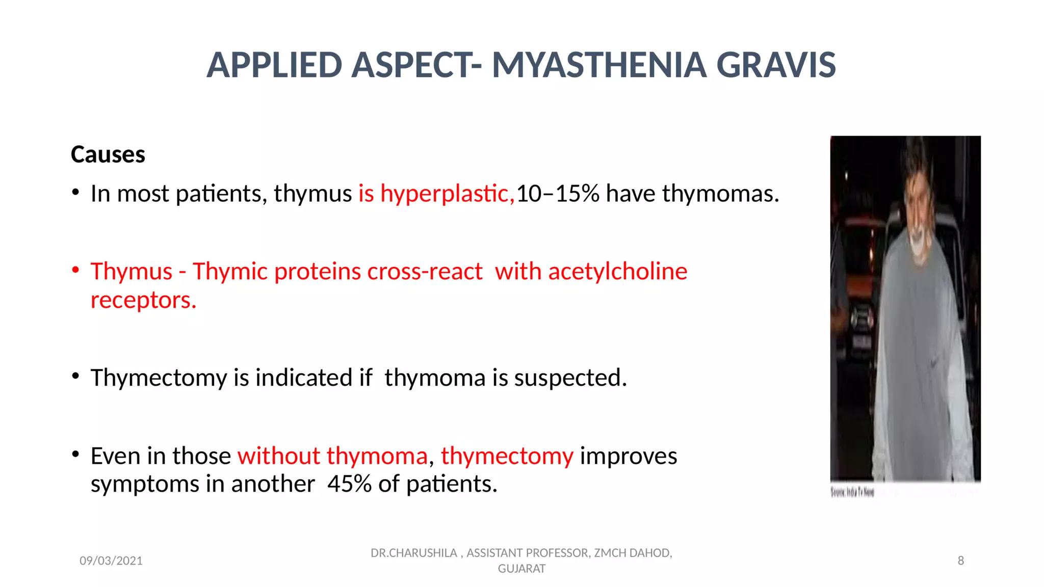 8. NM Myasthenia gravis,Lambert eaten syndrome,NM stimulators, NM ...