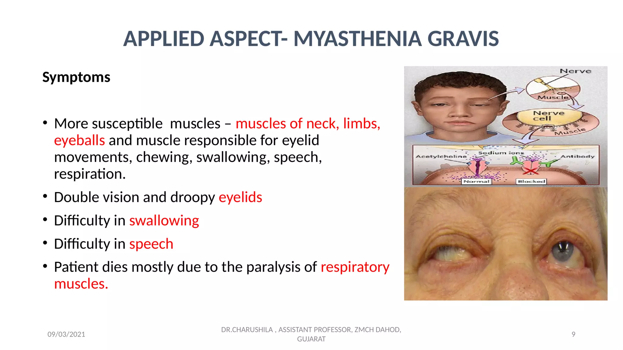 8. NM Myasthenia gravis,Lambert eaten syndrome,NM stimulators, NM ...