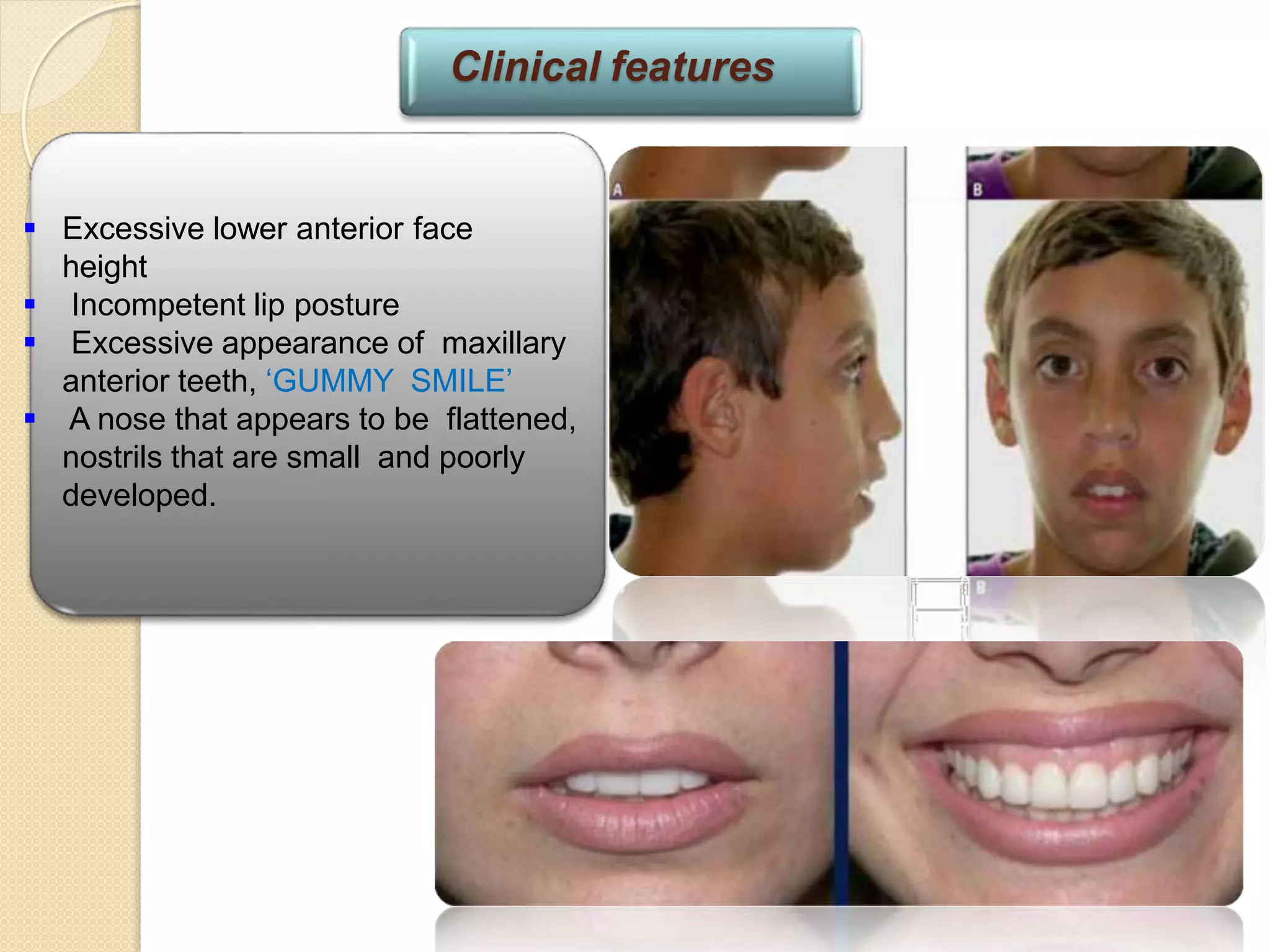 FUNCTIONAL INFLUENCES ON OROFACIAL DEVELOPMENT | PPTX