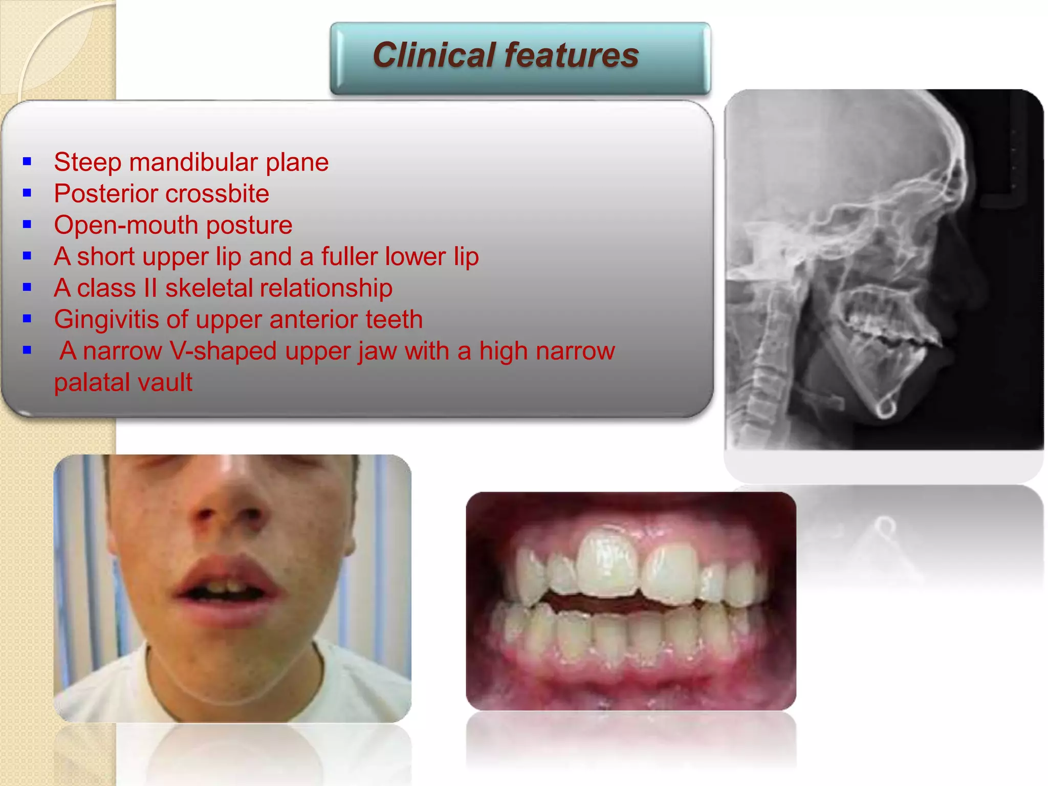FUNCTIONAL INFLUENCES ON OROFACIAL DEVELOPMENT | PPTX