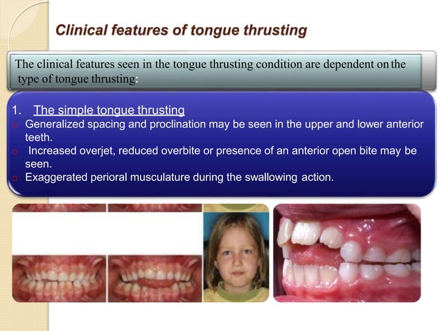 FUNCTIONAL INFLUENCES ON OROFACIAL DEVELOPMENT | PPTX | Ear, Nose and ...