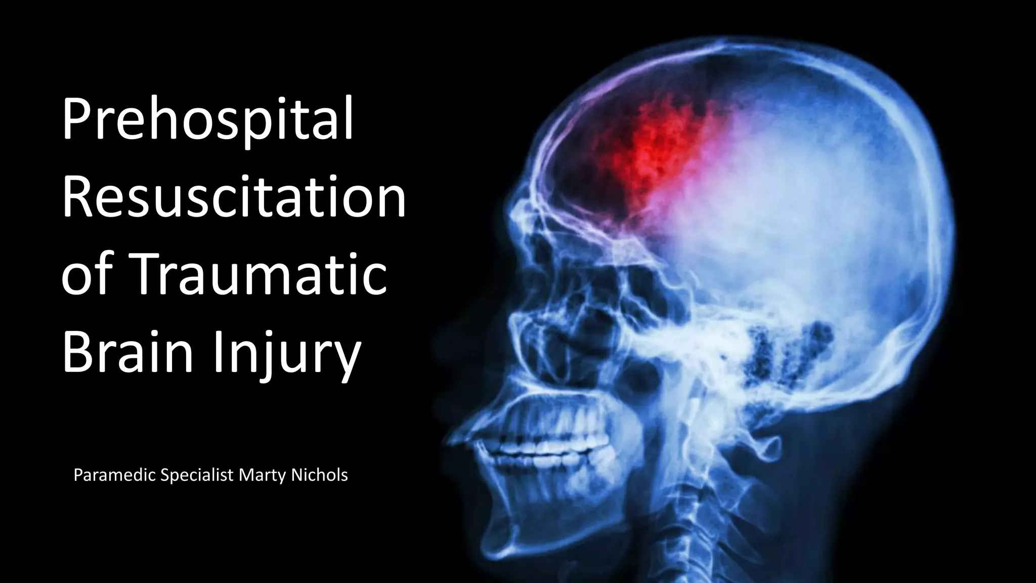 Prehospital resuscitation of TBI | PPT