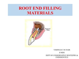 Retro grade filling | PPT | Dental Health | Diseases and Conditions