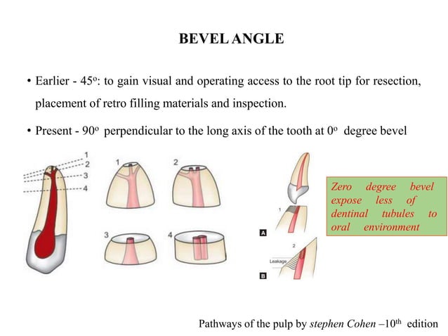 Retro grade filling | PPT | Dental Health | Diseases and Conditions