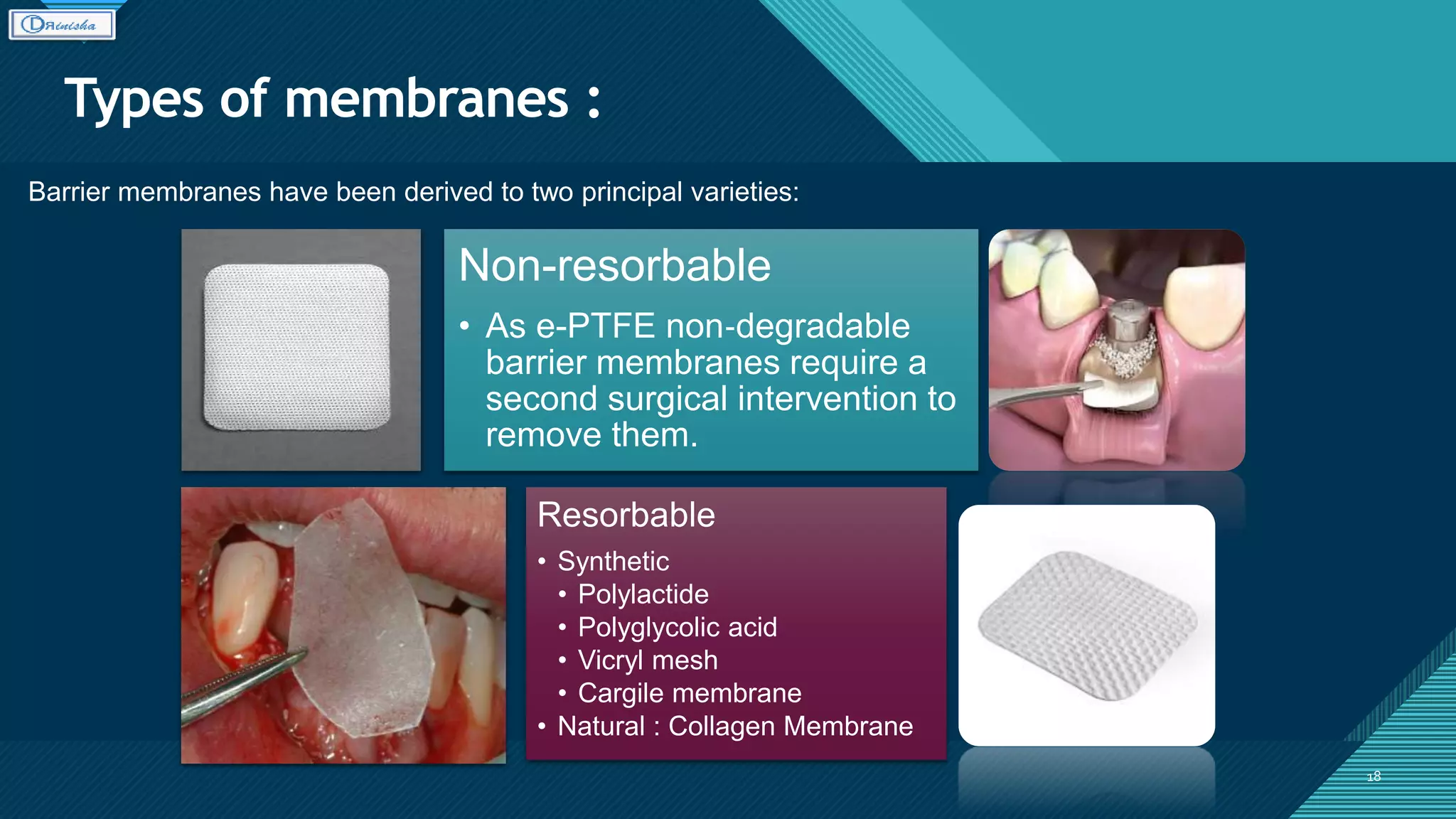 Hard Tissue Augmentation.pptx