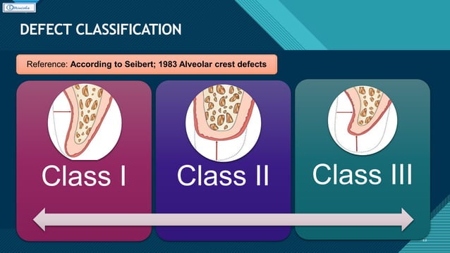 Hard Tissue Augmentation.pptx