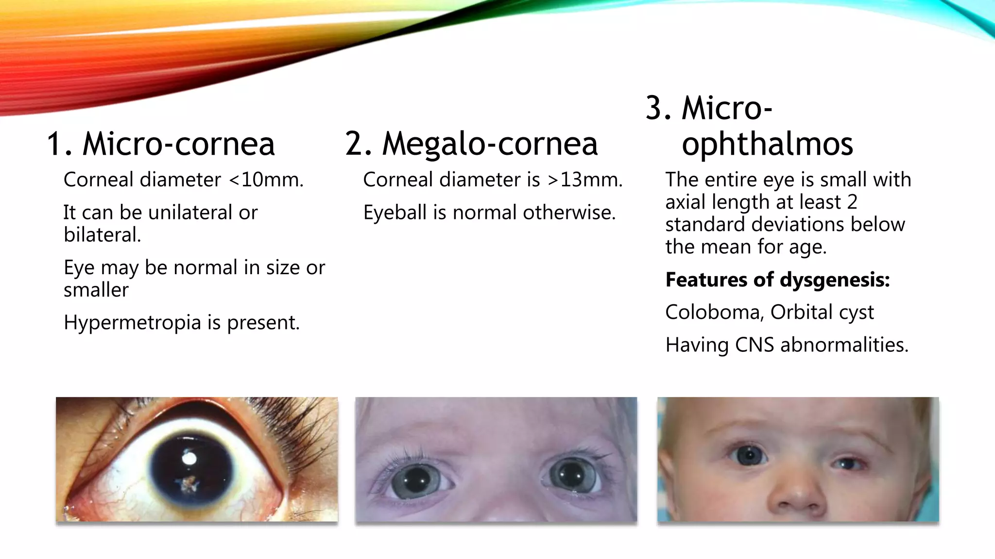 8. Corneal abnormalities & corneal ulcer.pptx