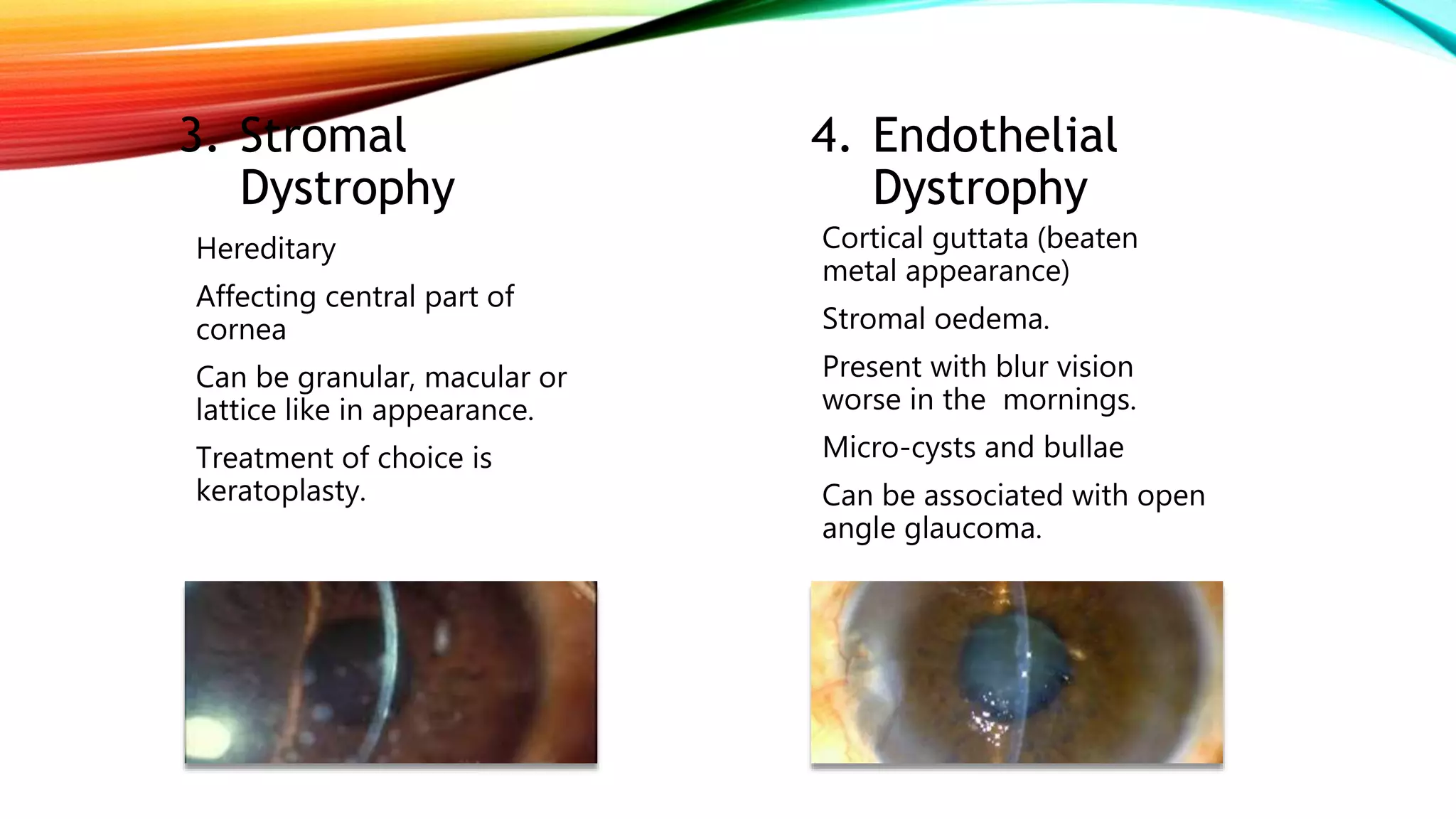 8. Corneal abnormalities & corneal ulcer.pptx