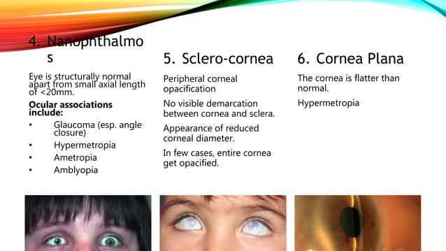 8. Corneal abnormalities & corneal ulcer.pptx
