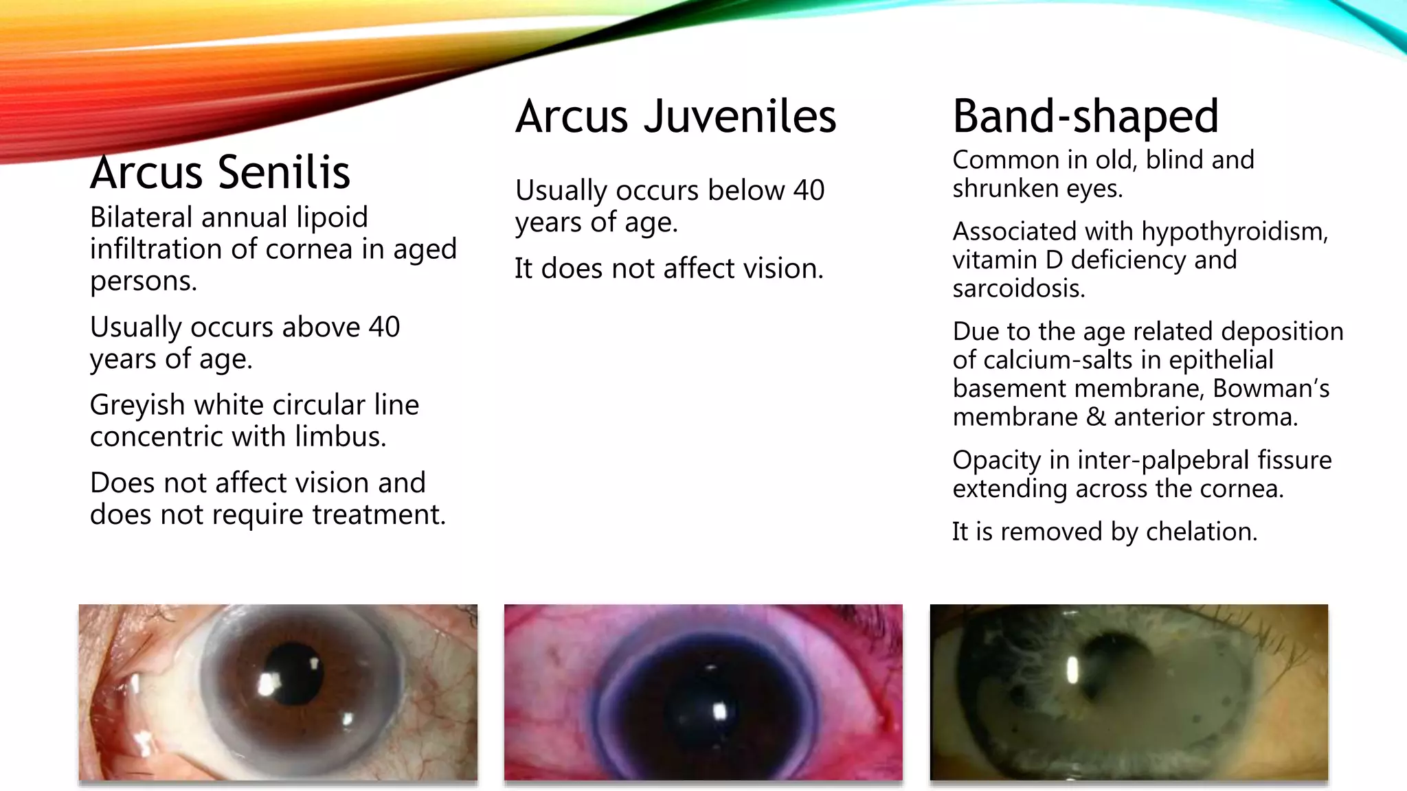 8. Corneal abnormalities & corneal ulcer.pptx