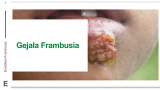 Paparan Sosialisasi Klinis Frambusia.pptx