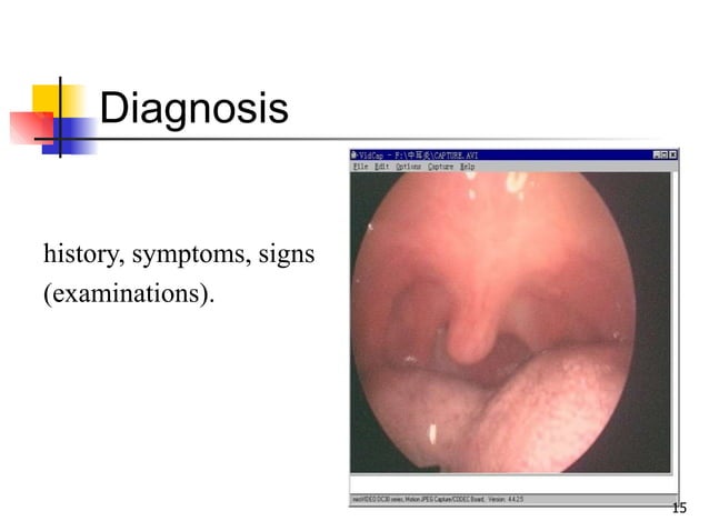 8. Acute Pharyngitis.pptx