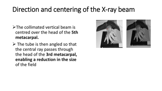 8.HAND PART 1.pptx